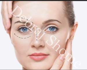 Benefits Of Orbital Surgery | Oculoplastic Eyelid Orbit Surgery